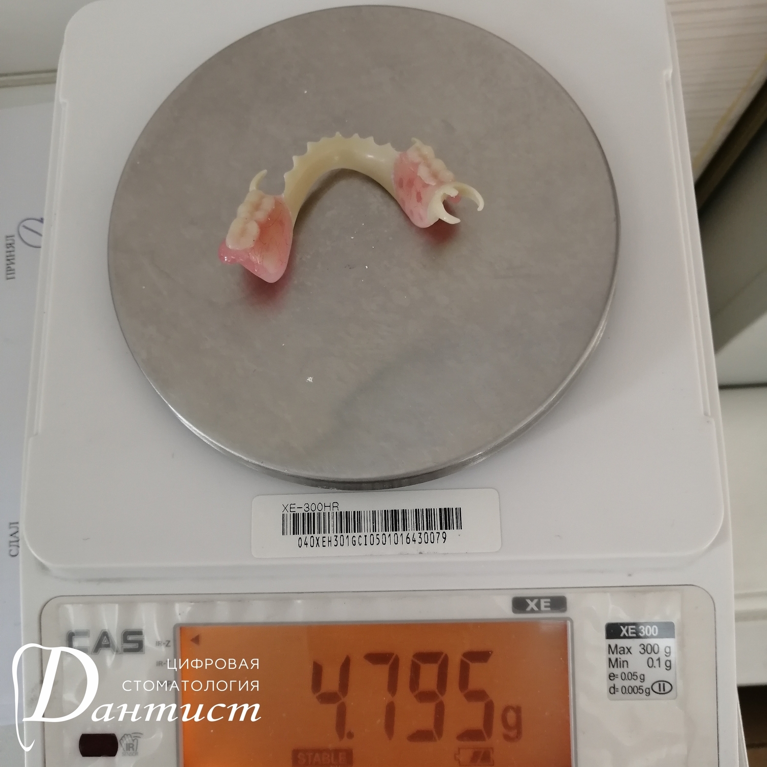 Инжекционные съемные протезы. Стоматология Дантист Орск.